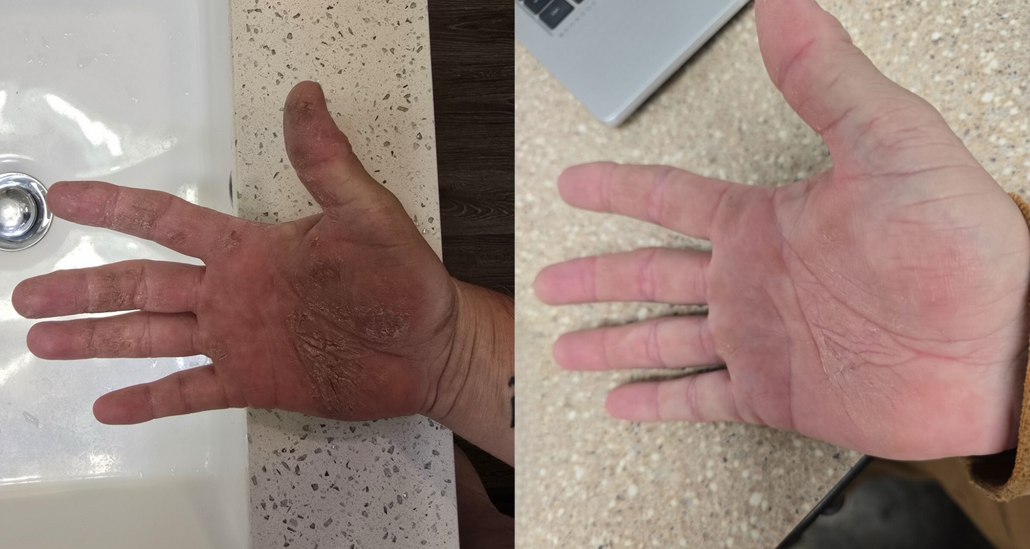 Hand care for athletes – HeavyHanded